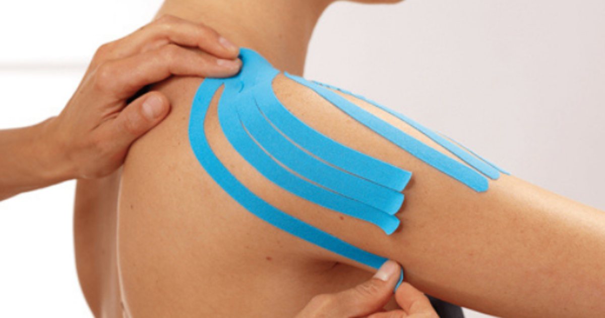 Four K-Tape Application Techniques for Your Clinical | Embodia